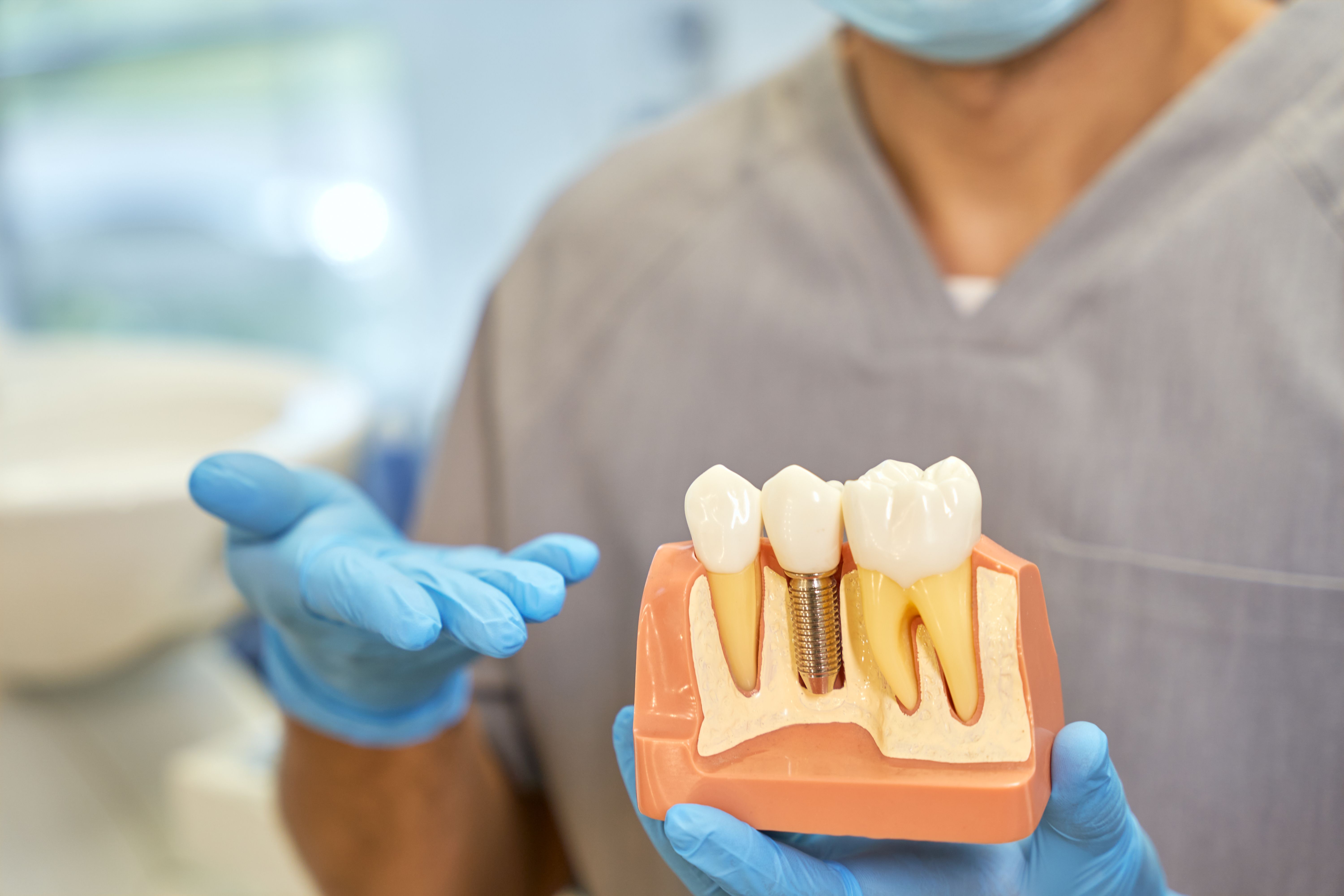 Dental Implant Surgery Recovery: Timeline and Tips for a Smooth Healing ...